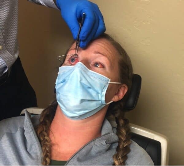 What to Expect With Suture Adjustments for Strabismus Surgery ...