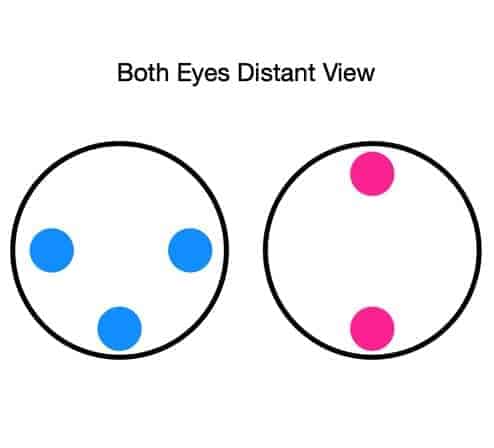 VT Appointments Feb 2021 – Visual Overstimulation – Strabismus Solutions