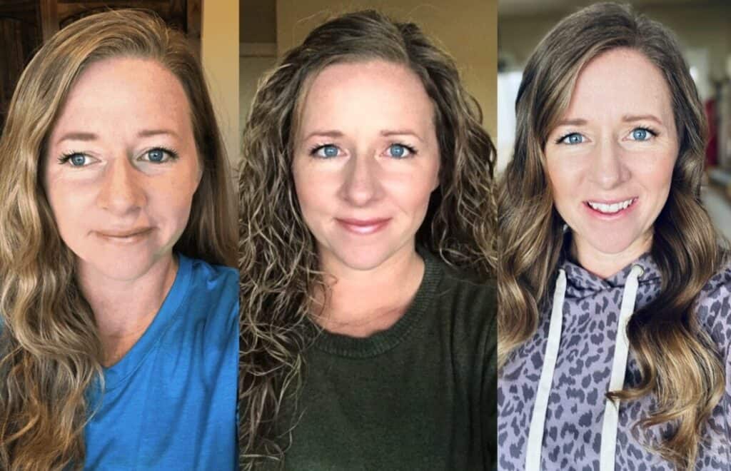 Strabismus Surgery One Year Later Did It Work Strabismus Solutions Strabismus Surgery One Year Later Did It Work Strabismus Solutions